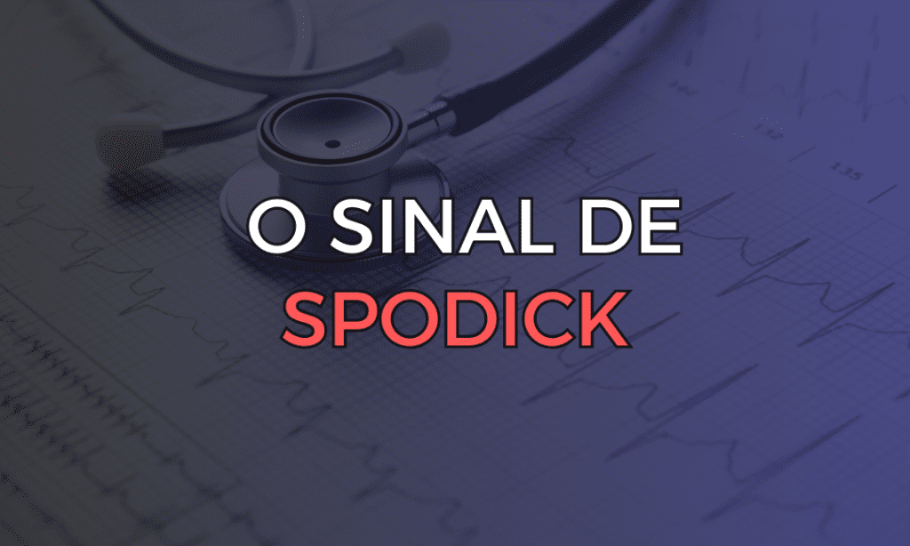Índice de Morris: Como Identificar a SAE no ECG - Aprenda ECG