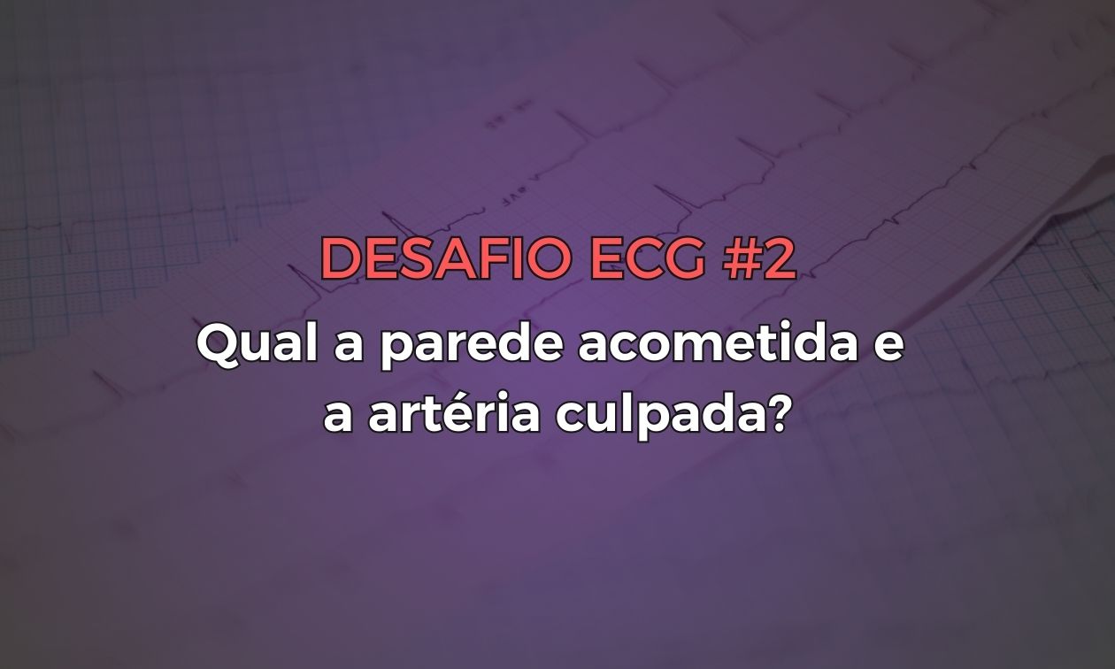 Desafio ECG #2: Qual a parede acometida e a artéria culpada? - Aprenda ECG