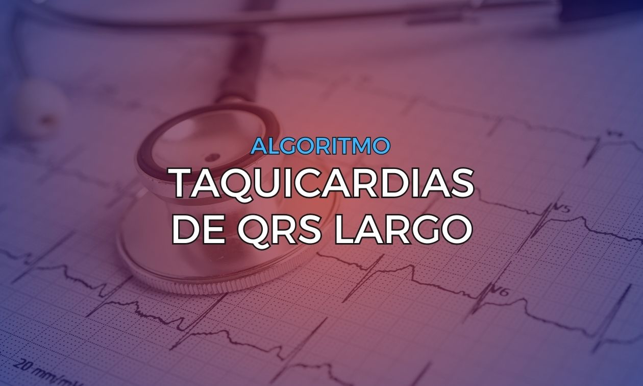 Manejo de Taquicardias de QRS Alargado na Sala de Emergência - Aprenda ECG