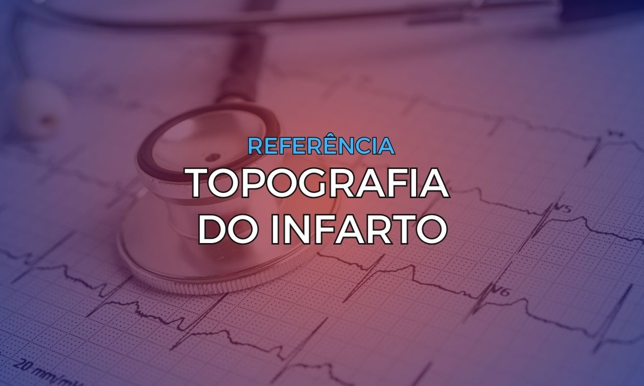 Topografia do Infarto - Aprenda ECG