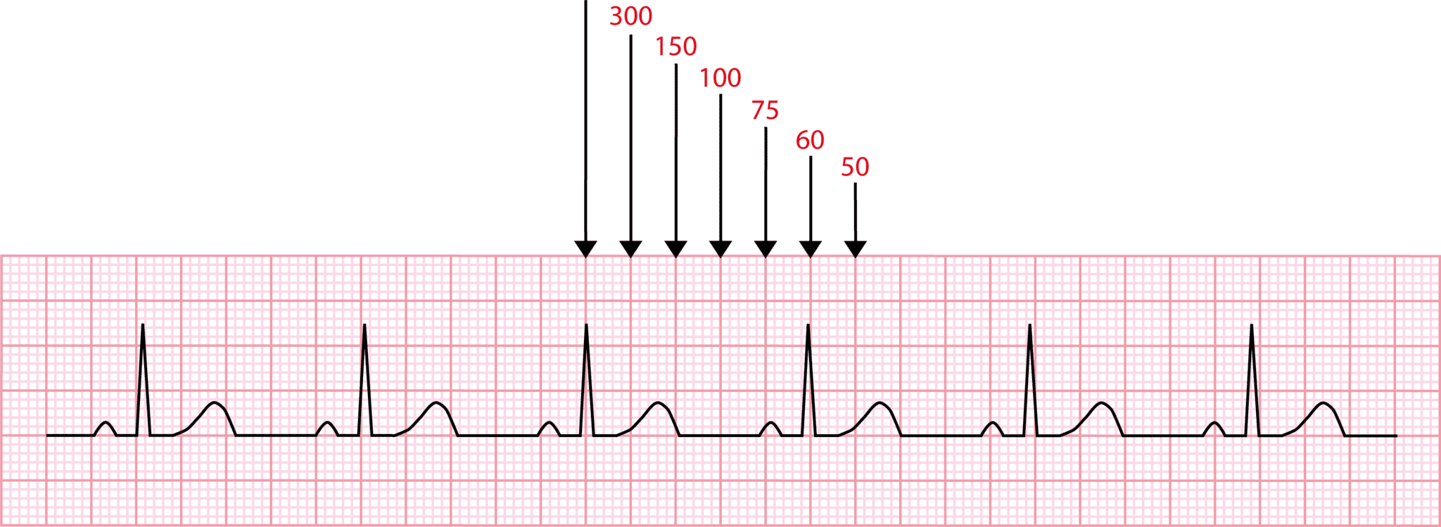 ECG Passo-a-Passo: Cálculo da Frequência Cardíaca - Aprenda ECG