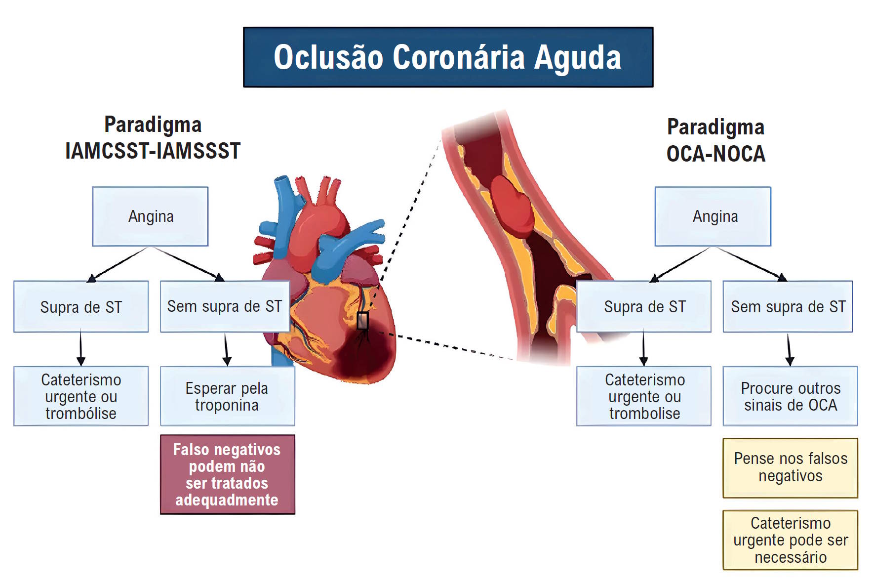 OCA e NOCA: Uma Nova Perspectiva para o Diagnóstico e Tratamento do ...