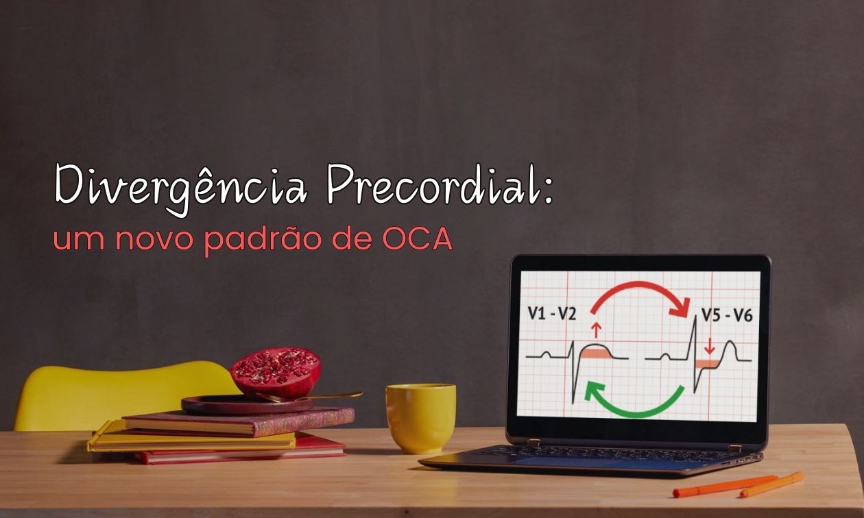 Divergência Precordial: um novo padrão de OCA - Aprenda ECG