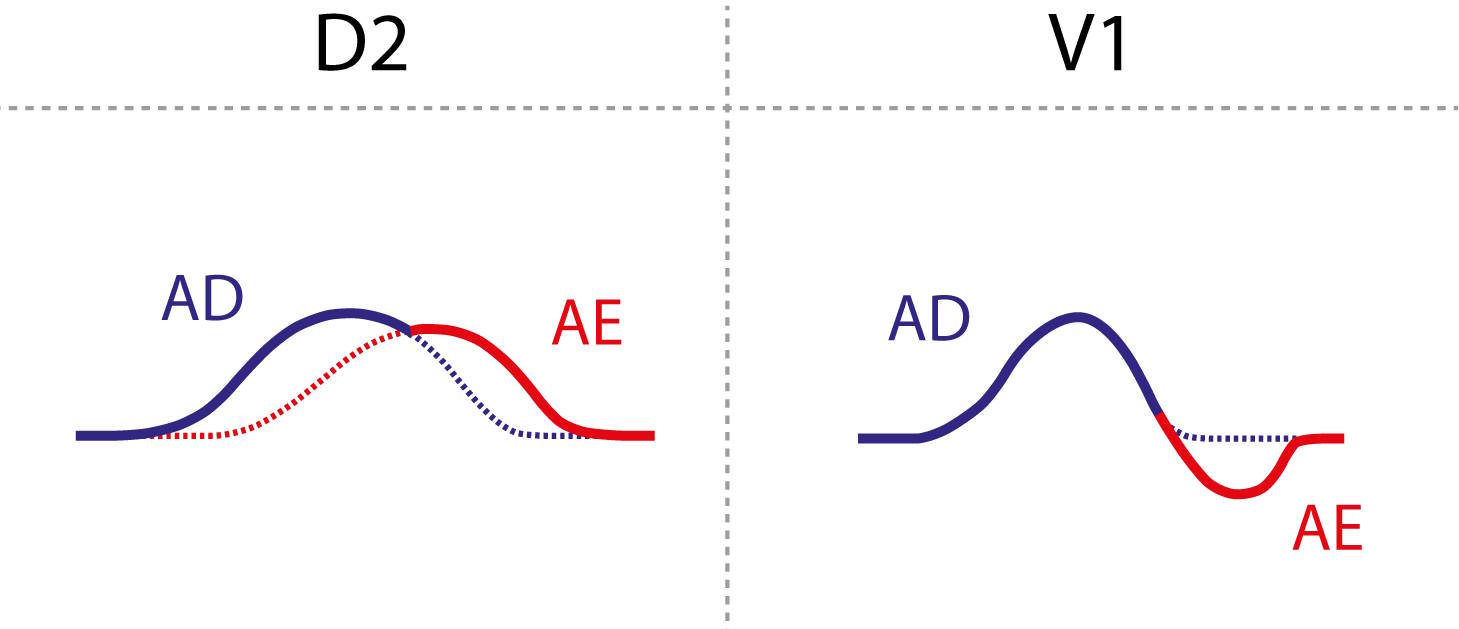 Onda P - Aprenda ECG